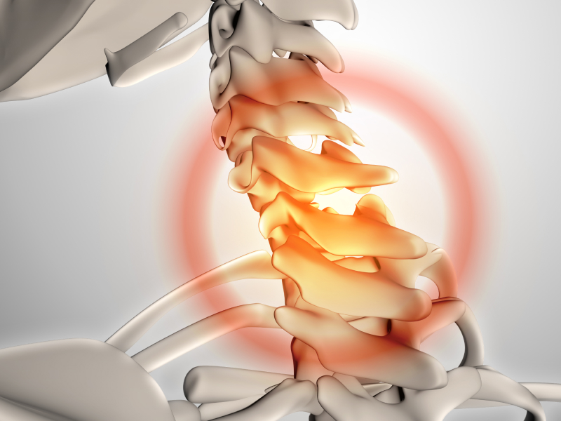Omurga Enfeksiyonları | Skolyoz | Skolyoz Nedir | Prof. Dr. Ahmet Alanay